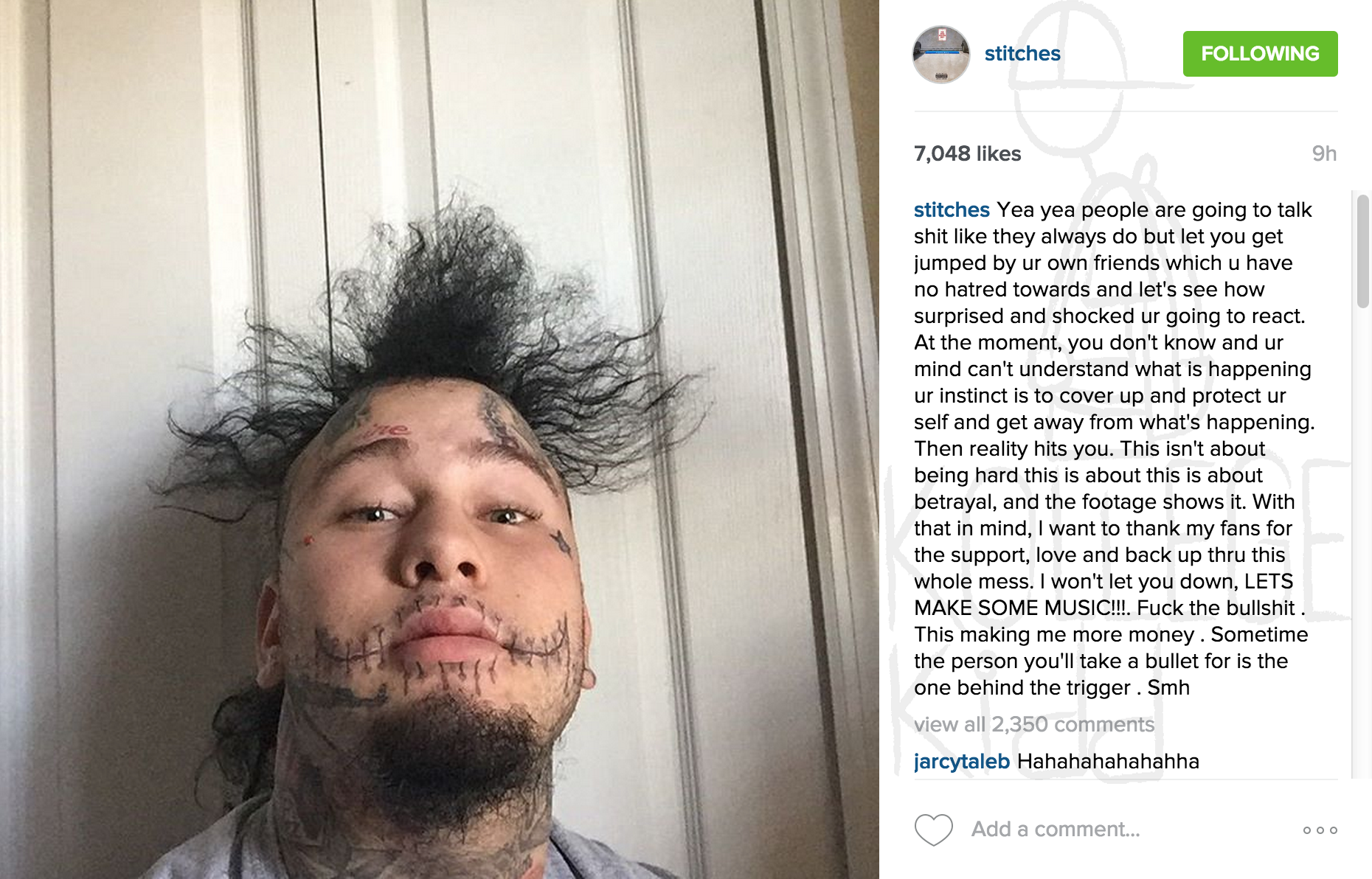 Stitches Reacts To Footage Of Himself Getting Jumped – Welcome To ...